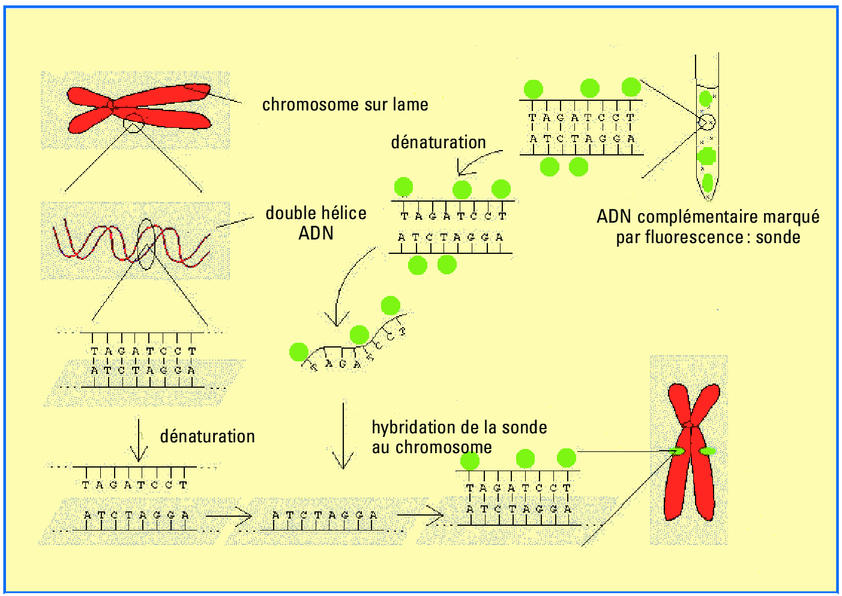 Anomalies Chromosomiques Structurelles