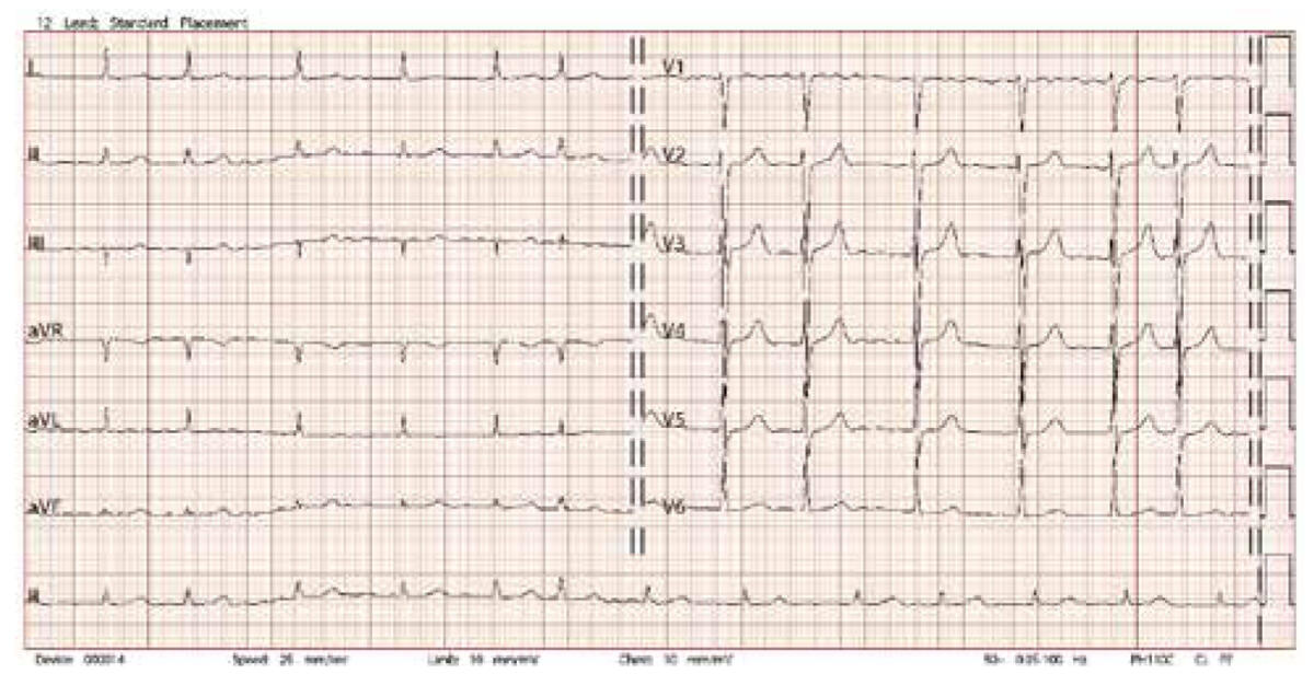 ECG | CARDIOGERIATRIE CLINIQUE A L'USAGE DU PRATICIEN 2E ED (Perrenoud ...