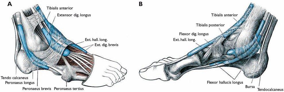 Diagnostic différentiel des ténosynovites