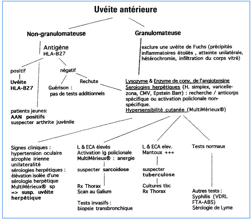 Uvéite Antérieure