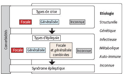 Pédiatrie. Nouvelle classification des crises épileptiques et des épilepsies
