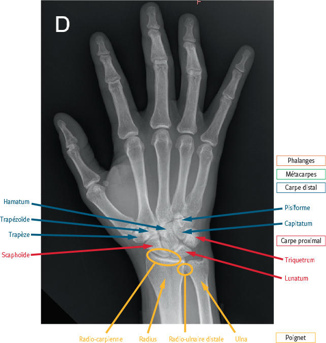 Radiographie Des Mains Rayons X Radiographie De La Tête Pied Tête