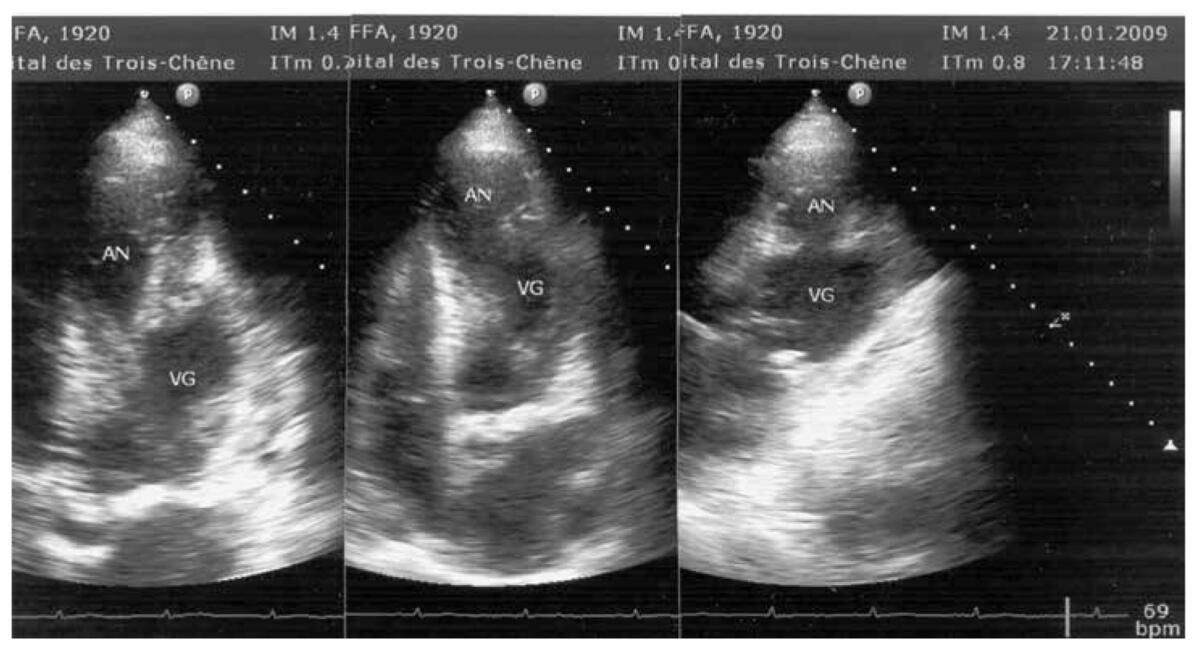 Techniques Diagnostiques | CARDIOGERIATRIE CLINIQUE A L'USAGE DU ...