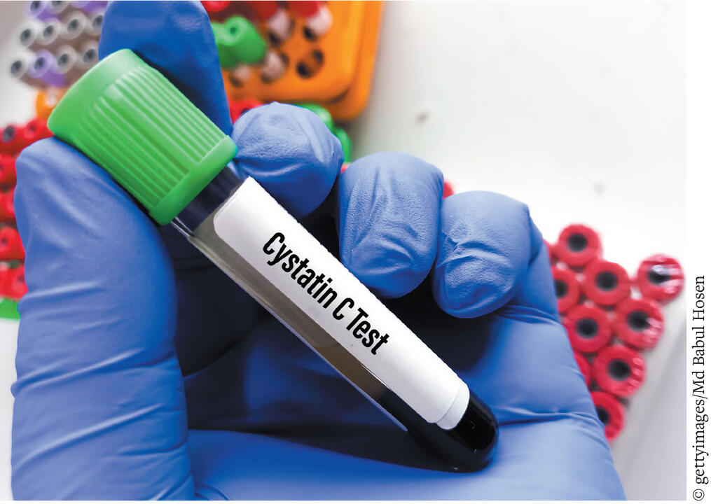 Cystatine C : un indicateur clé pour évaluer les risques rénaux et ...