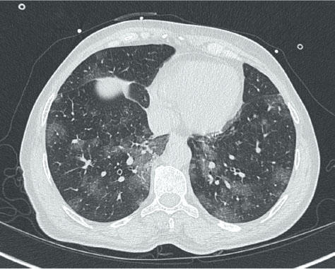 Limites de ces études