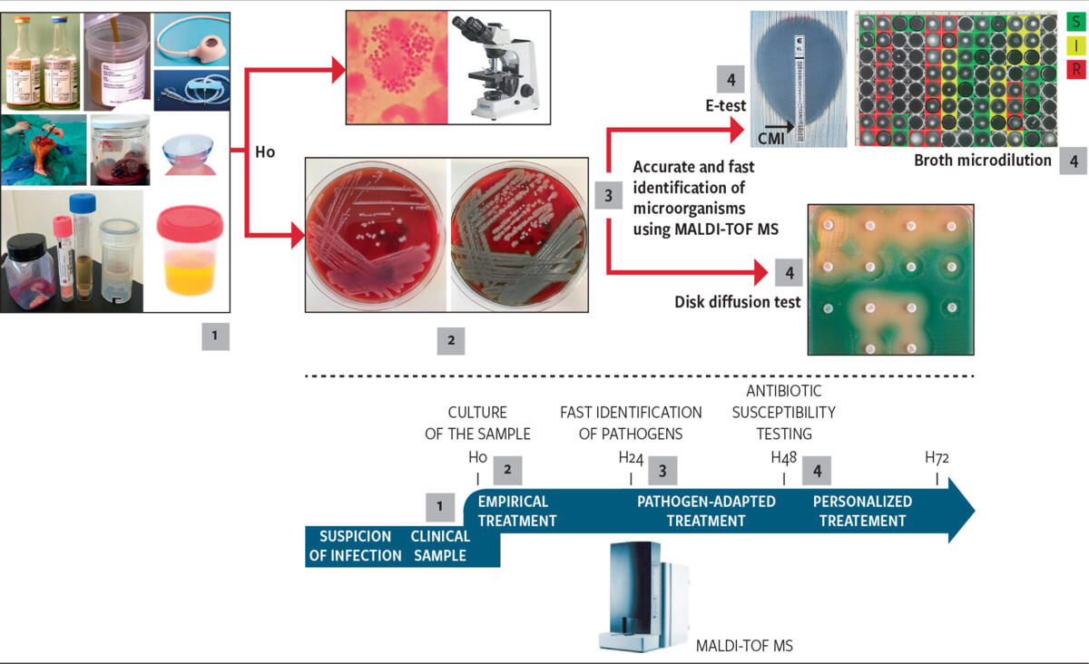 Lecture de l’antibiogramme dans un contexte de résistance aux antibiotiques