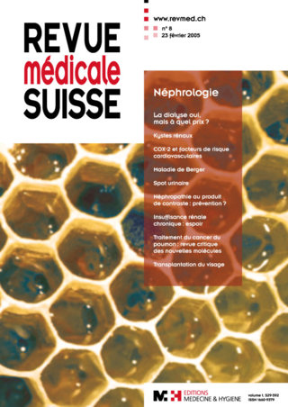 Le spot urinaire: utilité et pièges à éviter