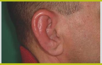 rougeur – Réalités Biomédicales