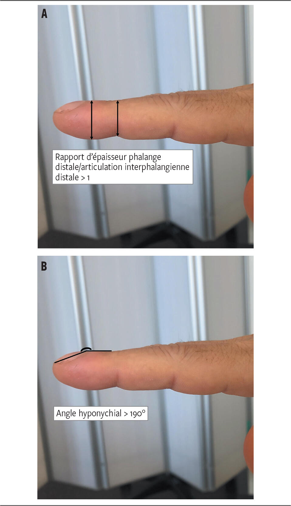 Hippocratisme digital