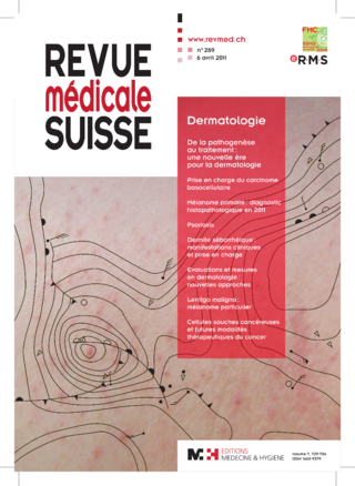 Dermite séborrhéique : manifestations cliniques et prise en charge