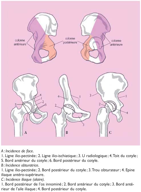 Traumatismes du bassin - Revue Médicale Suisse