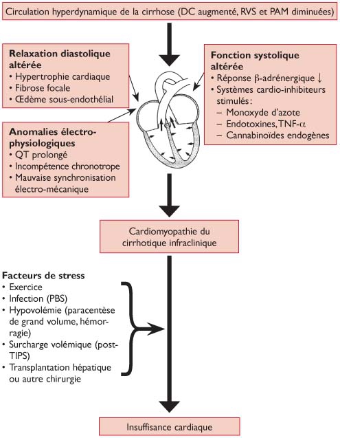La cardiomyopathie cirrhotique - Revue Médicale Suisse