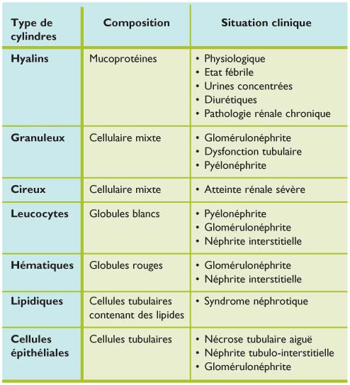 Analyse d’urines : l’ABC du praticien - Revue Médicale Suisse