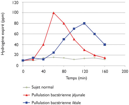 Pullulation bactérienne de l’intestin grêle - Revue Médicale Suisse