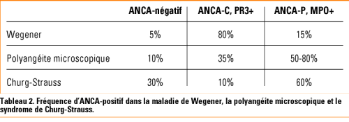 Vascularite à Anca Traitement des vascularites à ANCA en 2014