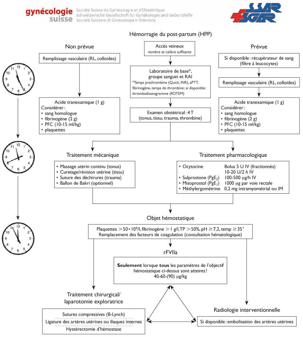 HEMORRAGIE DU POST PARTUM PDF HEMORRAGIE DU POST PARTUM PDF