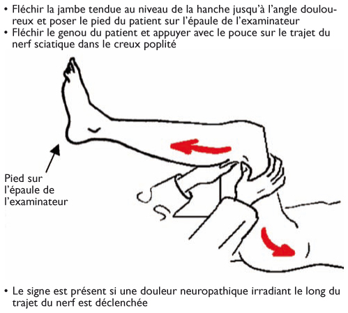 La lombalgie aiguë en médecine de premier recours - Revue Médicale Suisse