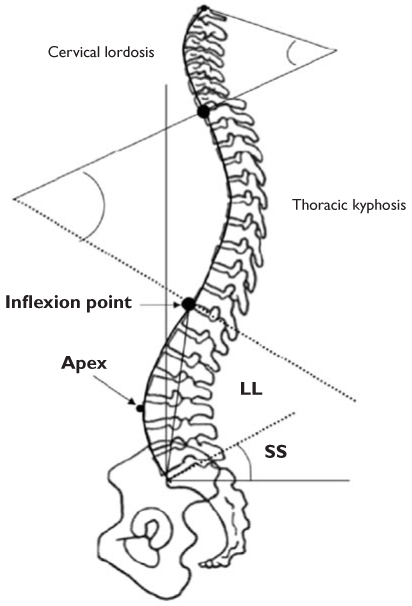 Analyse de l’équilibre sagittal du rachis - Revue Médicale Suisse