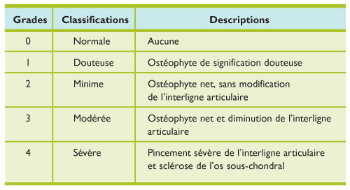 Imagerie et arthrose - Revue Médicale Suisse