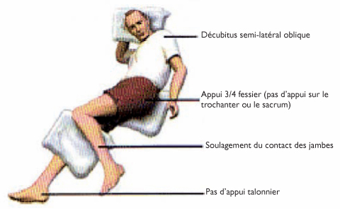 Personne âgée et escarres : prévention et traitement - Revue Médicale Suisse