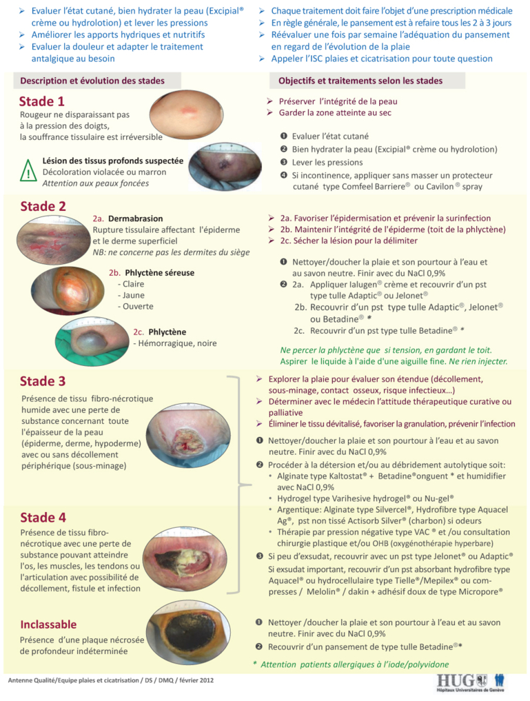 Personne âgée et escarres : prévention et traitement - Revue Médicale Suisse