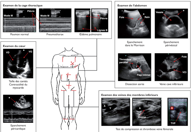Apport de l’échographie dans la prise en charge initiale des patients ...
