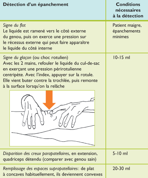 Gonalgies : que faire en médecine de premier recours ? - Revue Médicale ...