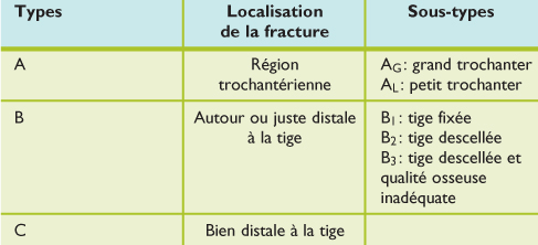 Fractures périprothétiques - Revue Médicale Suisse