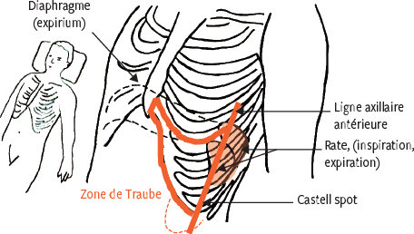Examen de l’abdomen : et si nous refaisions nos gammes ? - Revue ...