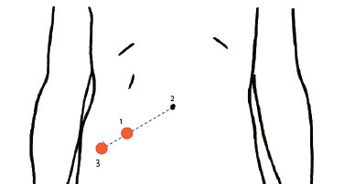 Examen de l’abdomen : et si nous refaisions nos gammes ? - Revue ...