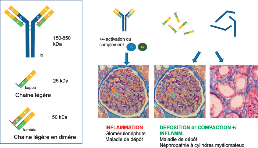 Avancées thérapeutiques dans les maladies rénales associéesaux ...