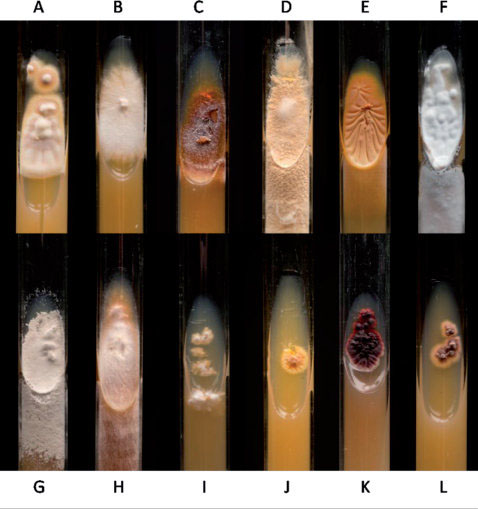 Récente révision des espèces de dermatophytes et de leur nomenclature ...