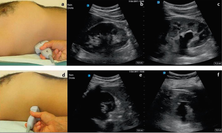 uroscanner prix maroc