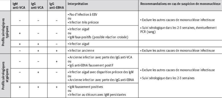 Causes fréquentes de mononucléose infectieuse - Revue Médicale Suisse
